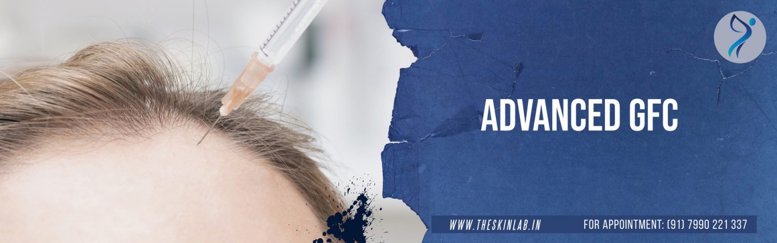 Best Advanced GFC Hair Loss Treatment by Dr Jayshree Savalia