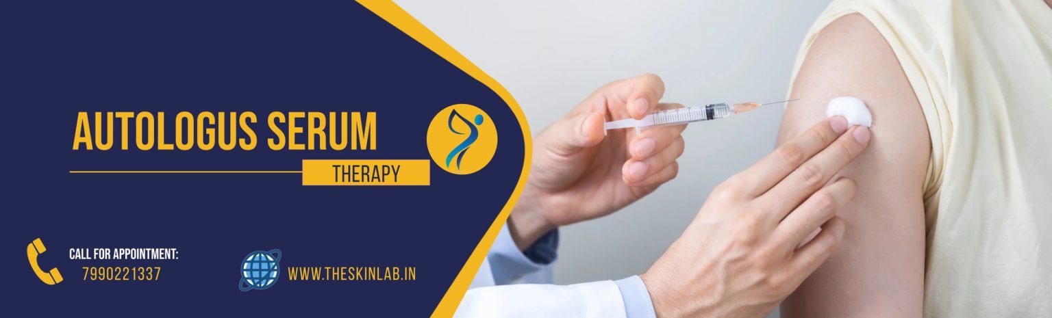 Autologous Serum Therapy - The Skin Lab