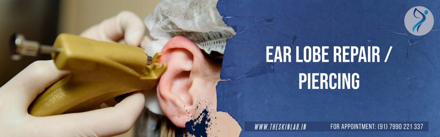 Ear Lobe Repair - The Skin Lab