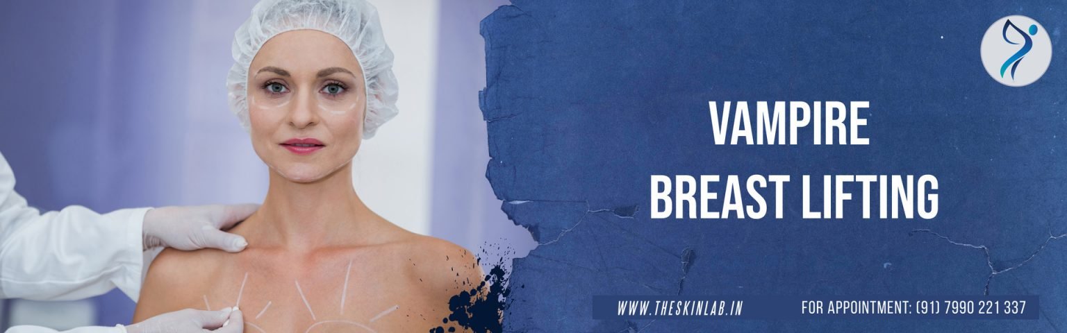 Vampire Breast lift - The Skin Lab | Dr. Jayshree | Surat | Gujarat